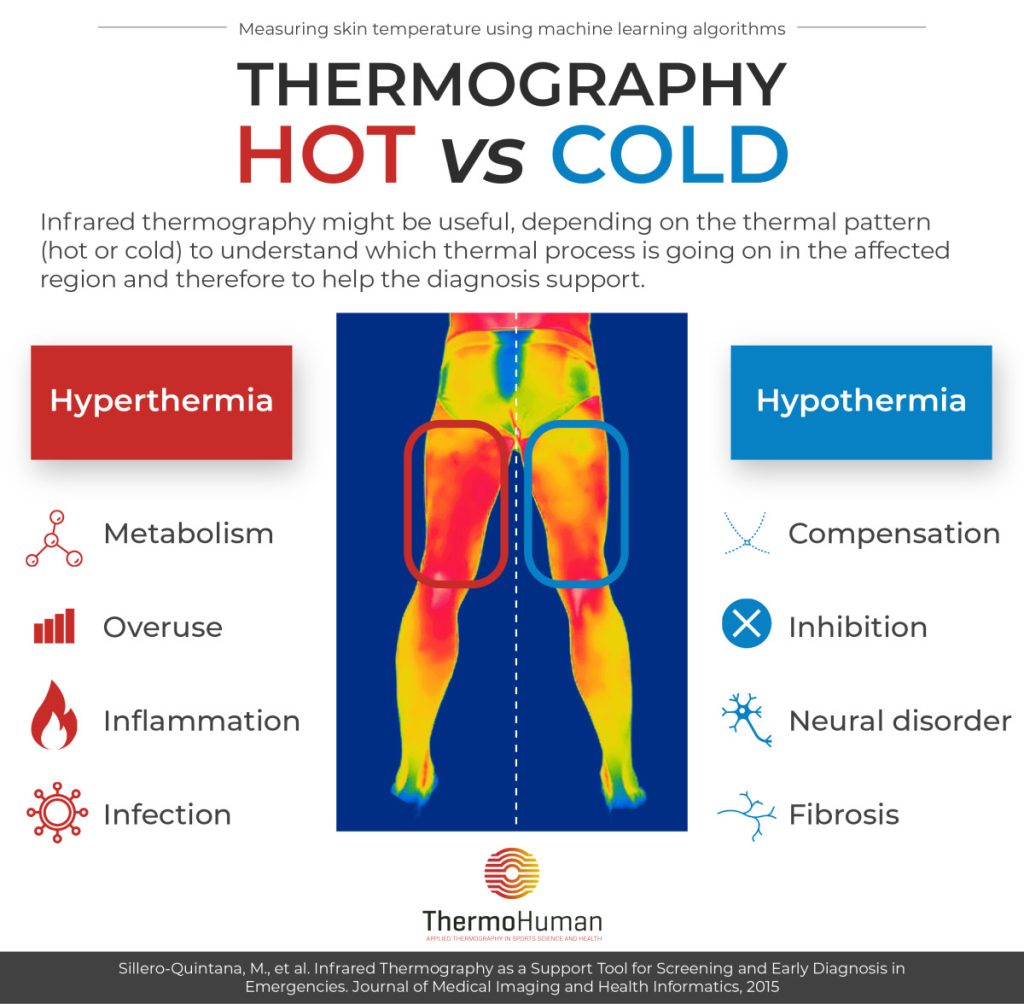 Is Infrared Hot or Cold? - Infrared for Health