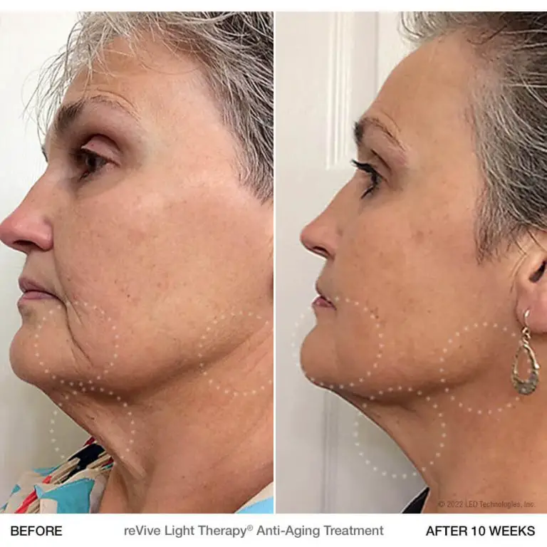 Beauty Angel RVT 30 : A Guide - Infrared for Health