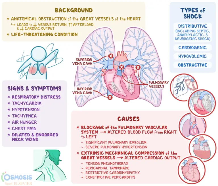 What Signs Are Present As Obstructive Shock Progresses? - Infrared for ...